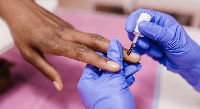 Hidrate as cutículas regularmente